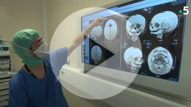 Centre de référence des craniosténoses et malformations cranio-faciales ... Centre de référence des craniosténoses et malformations cranio-faciales ...